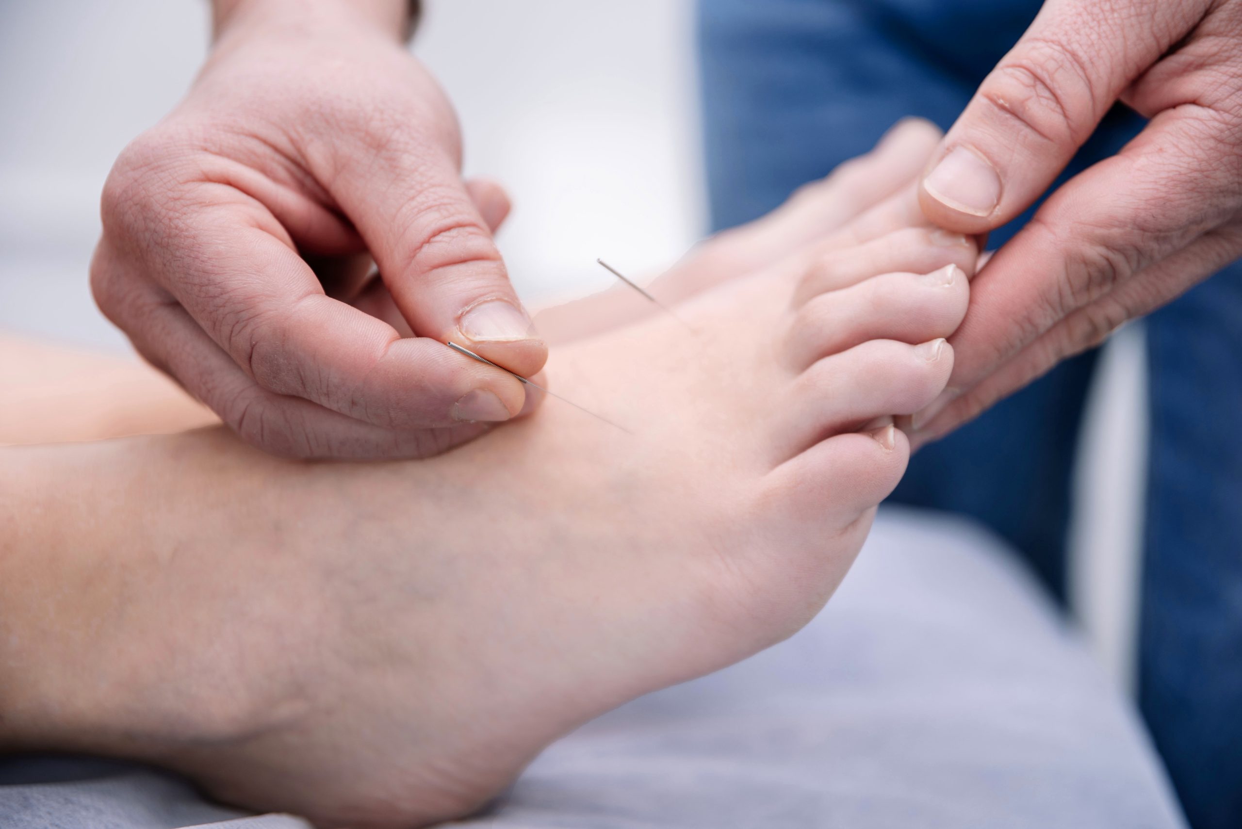 The Truth About Acupuncture for IVF Support Before and After Transfer ...